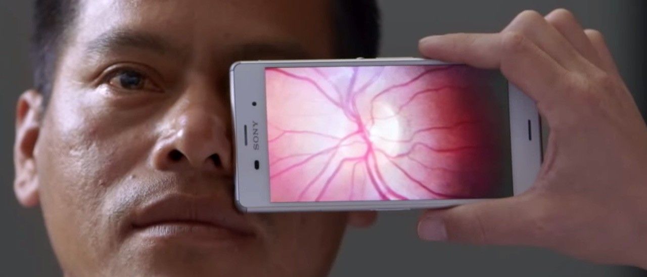 Peek Retina: visite oculistiche con lo smartphone - Webnews